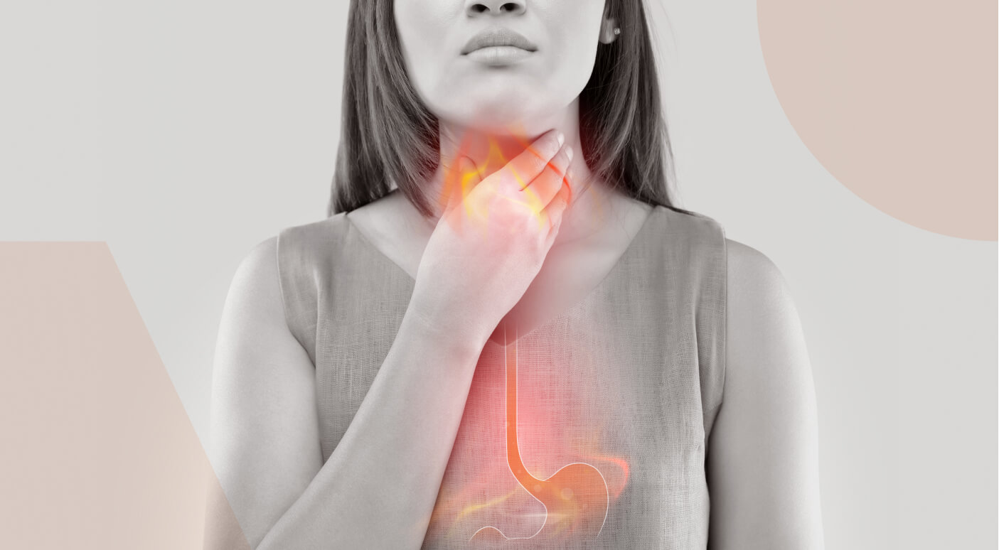 How to Avoid Acid Reflux (GERD) During Intermittent Fasting